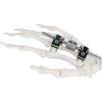 China Orthopedic Surgical Mini Fragment Ilizarov External Fixation Device for sale