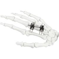 China Orthopedic Surgical Mini Fragment Ilizarov External Fixation Device for sale