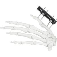 China Orthopedic Surgical Mini Fragment Ilizarov External Fixation Device for sale