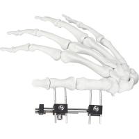 China Orthopedic Surgical Mini Fragment Ilizarov External Fixation Device for sale
