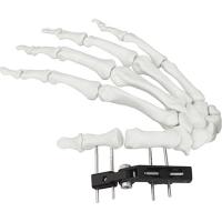 China Orthopedic Surgical Mini Fragment Ilizarov External Fixation Device for sale