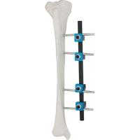 China Quality Assured Orthopedic Surgical Instruments Tibial External Fixator AO External Fixation Orthopedic Implant for sale