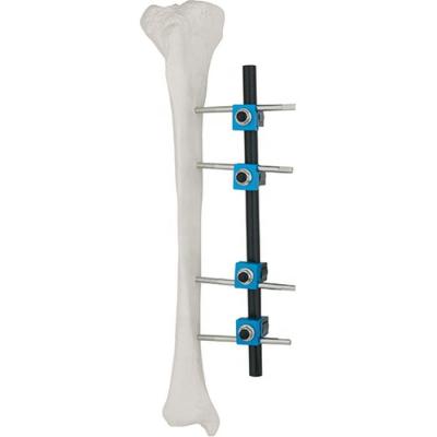 China Quality Assured Orthopedic Surgical Instruments Tibial External Fixator AO External Fixation Orthopedic Implant for sale