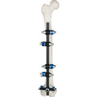 China Condylar External Fixation Device for sale