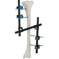 China Condylar External Fixation Device for sale