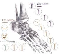 China Orthopedic Implant Bone Fracture Titanium Locking Plate For Hands Foot for sale