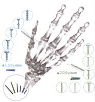 China Orthopedic Implant Bone Fracture Titanium Locking Plate For Hands Foot for sale