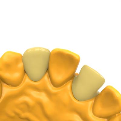 China Biocompatible Permanent Crown Bridge Resin Hot Deformation Temperature 80C Bending Strength 180-208 Mpa for sale