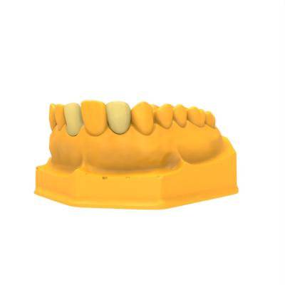 China 80C Hot Deformation Resistant Permanent Crown Bridge Resin for Longevity for sale
