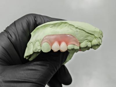 China Flexible Resin vs Hard Resin Better Elasticity and Softness for Invisible Denture Base Resin for sale