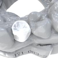 China Dental Crowns Permament Resin High Precision for Superior Results in Crown Restoration for sale