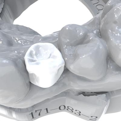 China Dental Crowns Permament Resin High Precision for Superior Results in Crown Restoration for sale