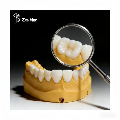 China Composite Resin Temporary Veneers Perfect for Temporary Aesthetic Restoration Offering Application and Long Lasting Wear for sale