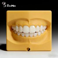 China Shelflife 2 Years Temporary Restoration Materials Natural Tooth Shade Suitable for Various Dental Restoration Procedures for sale