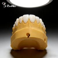 China Natural Tooth Shade Temporary Veneer Composite Resin Temporary Dental Solution Shelflife 2 Years Suitable for Professional for sale