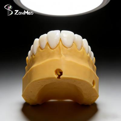 China Natural Tooth Shade Temporary Veneer Composite Resin Temporary Dental Solution Shelflife 2 Years Suitable for Professional for sale