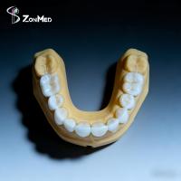 China Shelflife 2 Years Temporary Veneers Alternatives to Braces Featuring Thickness 0.3 to 0.98 Mm Crafted for Orthodontic Treatments for sale