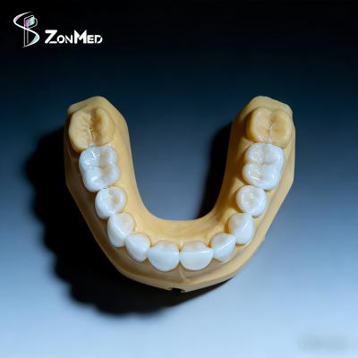 China Shelflife 2 Years Temporary Veneers Alternatives to Braces Featuring Thickness 0.3 to 0.98 Mm Crafted for Orthodontic Treatments for sale
