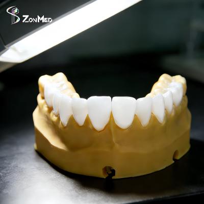 China Direct Bonding Chairside Temporary Veneers Thickness 0.3 to 0.98 Mm Suitable for Temporary Dental Restoration Solutions for sale