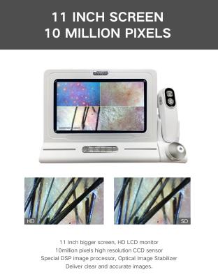 China ABS PC 15 Inch HD Screen 200X Camera USB Digital Hair And Skin Analyzer for sale