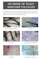 China ABS PC 15 Inch HD Screen 200X Camera USB Digital Hair And Skin Analyzer for sale