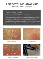 China ABS PC 15 Inch HD Screen 200X Camera USB Digital Hair And Skin Analyzer for sale