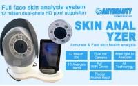 China 12 Million Pixel Portable Skin Analysis Skin Care Analyzer 32G for sale