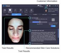 China AI Intelligent Image 1024*1280 Portable Skin Care Analyzer 160G for sale