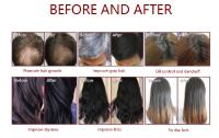 China 650nm High Frequency Laser Hair Growth Machine Multifunctional for sale