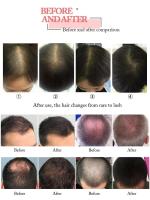 China 260pcs Diode Laser Lamps Laser Hair Growth Machine Hair Therapy LED Grow for sale
