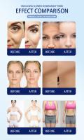 China 12 Lines Vertical 7D 9D HIFU Beauty Machine 2 In 1 For Body Buttocks for sale