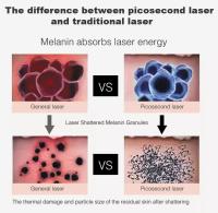China Tattoo Removal Picosecond Laser Machine 755nm 1064nm 1320nm for sale
