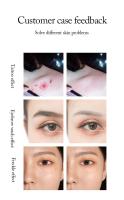 China Non Invasive Light Sensing Picosecond Laser Machine Tattoo Removal 532nm 1064nm for sale