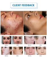 China 6 Colors Photodynamic Facial PDT LED Light Therapy Machine 1000W for sale