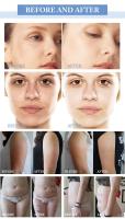 China 40KHZ Body Shaping  Machine Infrared Contouring V99 for sale