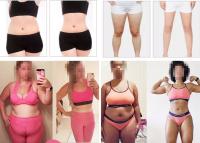 China 650nm Lipo Lase  Machine At Home for sale