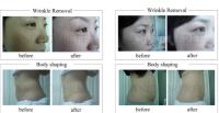 China SPA Salon Big Vacuum RF Roller Body Sculpting Vela Slim Machine OEM for sale