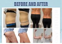China RF V9 Slimming Treatment Vela Shape 3 Machine 40k Cavitation for sale