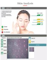 China 3 Spectrum Scalp Analyzer Detector Portable Scalp Hair Follicle 720P 1080P for sale