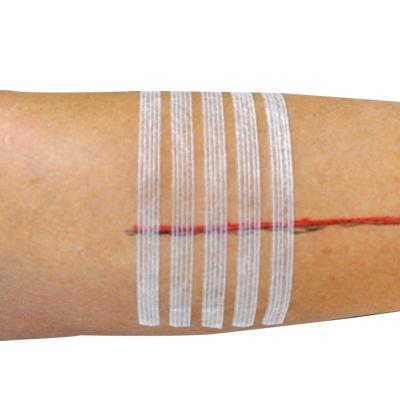 China Sterile  Wound Closure Strip First Aid Kit Supplies And Equipment For Camping for sale