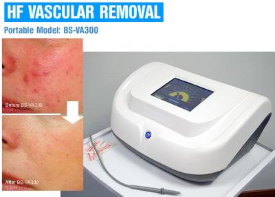China Painless 30MHz High Frequency Skin Care Machine For Spider Vein Treatment for sale