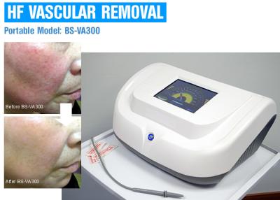 China High Frequency Red Blood Vascular Removal Machine With Pulse / Continuous Work Mode for sale