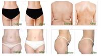 China Comfortable Weight Reduction Cryo Body Sculpting Machine For Beauty Salon for sale
