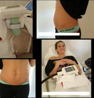 China Salon Cryo Fat Freezing Machine , Cryo Lipo Fat Freeze Equipment For Fast Fat Reduction for sale