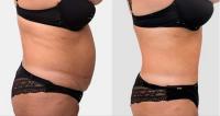 China Infrared Light Vacuum RF Slimming Machine  System For Fat Burning for sale