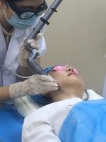 China Wrinkle Remover Beauty Equipment Scanning Fractional Co2 Laser Machine for sale