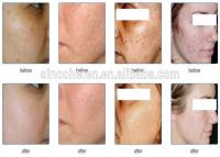 China Professional IPL Skin Rejuvenation Machine , Intense Pulsed Light Hair Removal Machine for sale