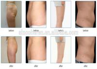 China Portable Cavitation Body Slimming Machine Fat Melting Ultrasonic Cavitation for sale