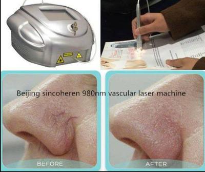 China Portable Mini 980nm Diode Vascular Removal Machine , Spider Vein Removal Machine for sale