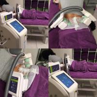 China Safe  Fat Reduction Device Without  Knives And  Suction Hoses for sale
